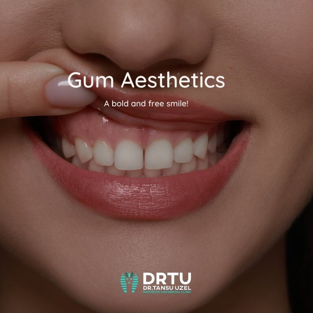 What is Pink Aesthetics? Gum Aesthetics - Dr. Tansu Uzel